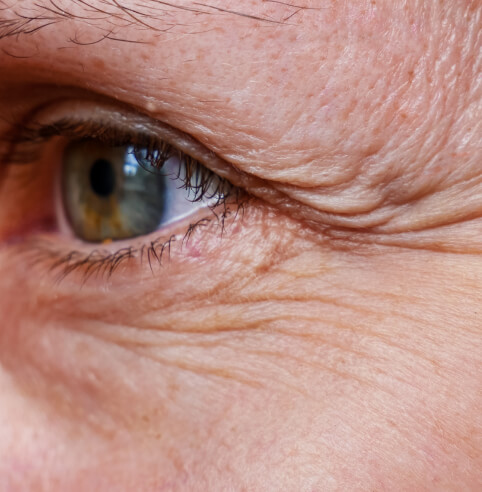 Effective Anti-Aging Creams - Tretinoin, Hyaluronic Acid, And ...