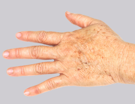 Body Skin Treatments | Body Cream | Neck Cream | Musely