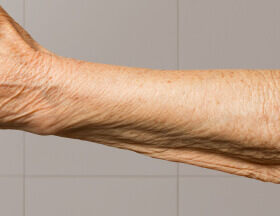 Body Skin Treatments | Body Cream | Neck Cream | Musely