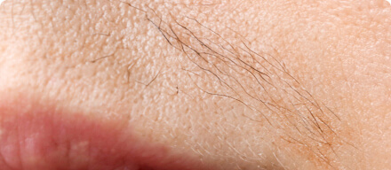 Rosacea Treatment | Facial Hair Removal | Anti-Aging Cream | Musely