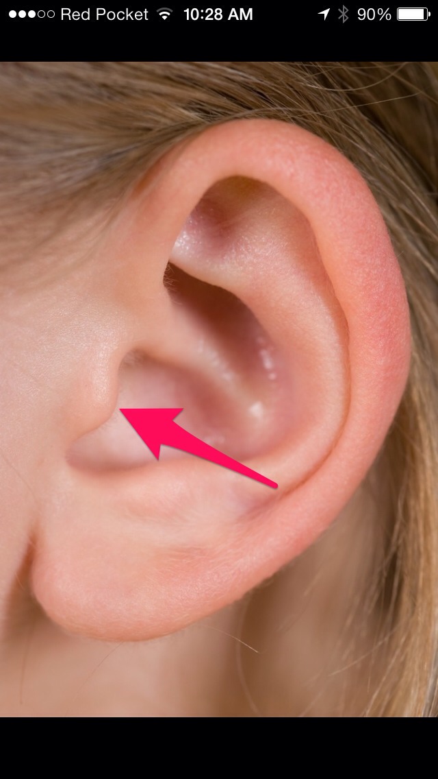 Why Do I Have Little Bumps On My Earlobe at Olga Rayford blog